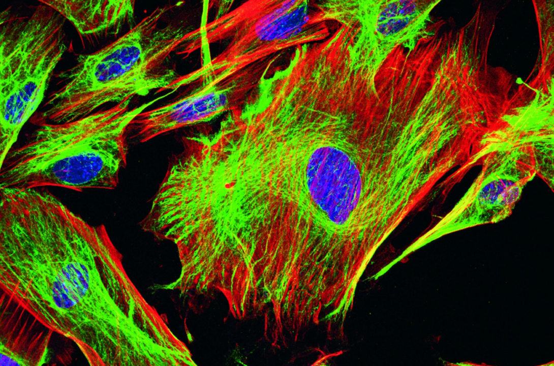 Physicists from Around the World Investigate Microscopic Filament ...